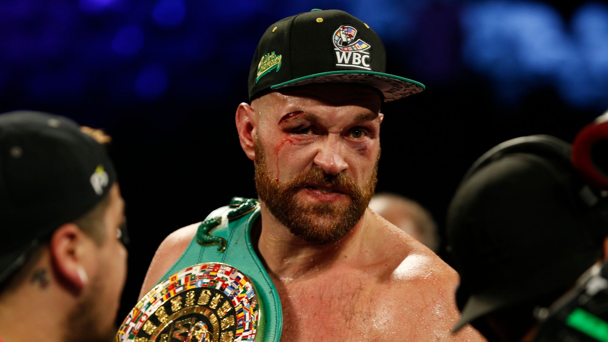 Expert Believes Fury's Cut Will Reopen and Haunt Him Throughout His ...