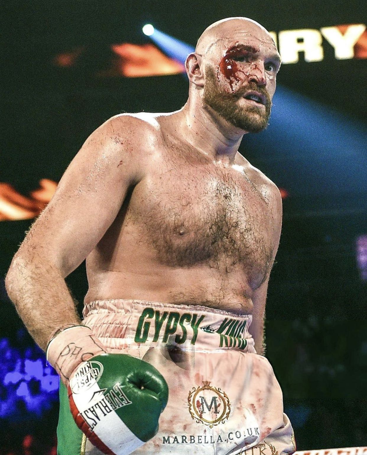 "The Era of Heavyweight Renaissance": Fury on the Current Super ...